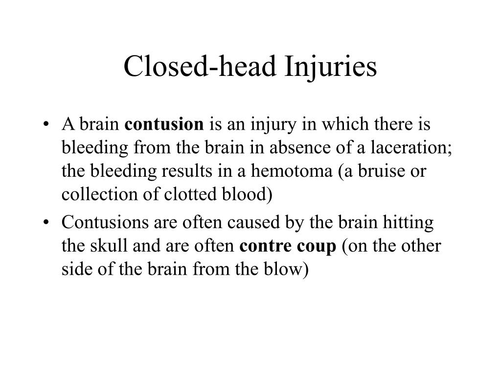 PPT - Neuroplasiticity ch. 10 and Cerebral Hemispheres ch. 16 ...