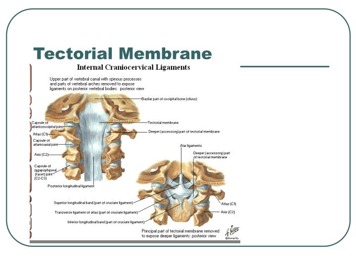 PPT - Vertebral Column PowerPoint Presentation - ID:1284846