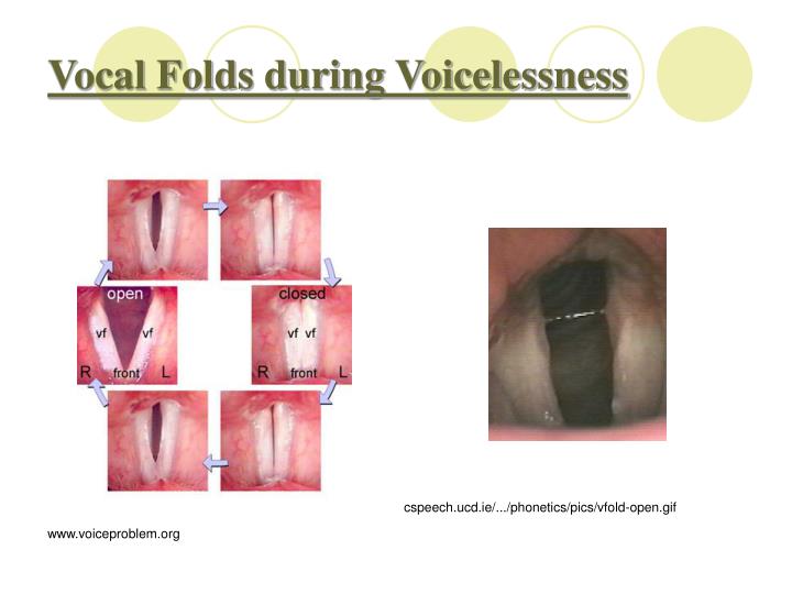 PPT - Voicing & Phonation PowerPoint Presentation - ID:1290692