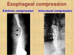 PPT - Diseases of Esophagus & Dysphagia PowerPoint Presentation - ID ...