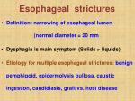 PPT - Diseases of Esophagus & Dysphagia PowerPoint Presentation - ID ...