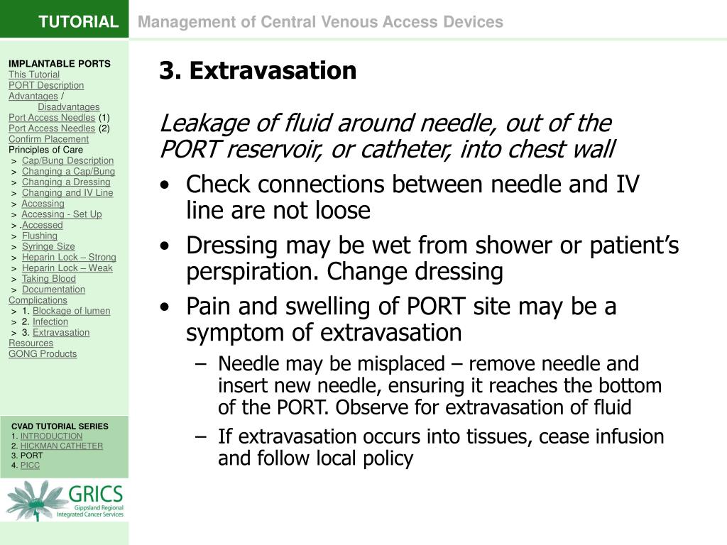 PPT - 3. IMPLANTABLE PORTS PowerPoint Presentation, free download - ID ...
