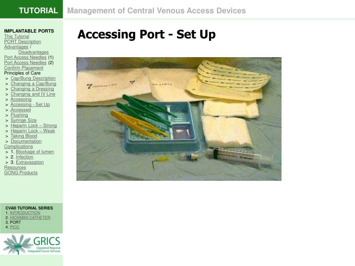 PPT - 3. IMPLANTABLE PORTS PowerPoint Presentation - ID:1294487