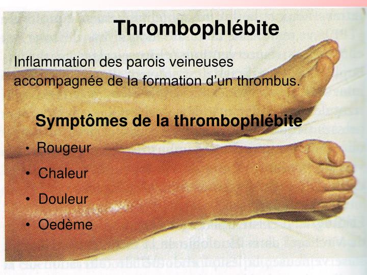 PPT - Maladies cardiovasculaires PowerPoint Presentation - ID:1302147