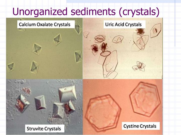 PPT - Lab Ex 57: Urinalysis PowerPoint Presentation - ID:1305691