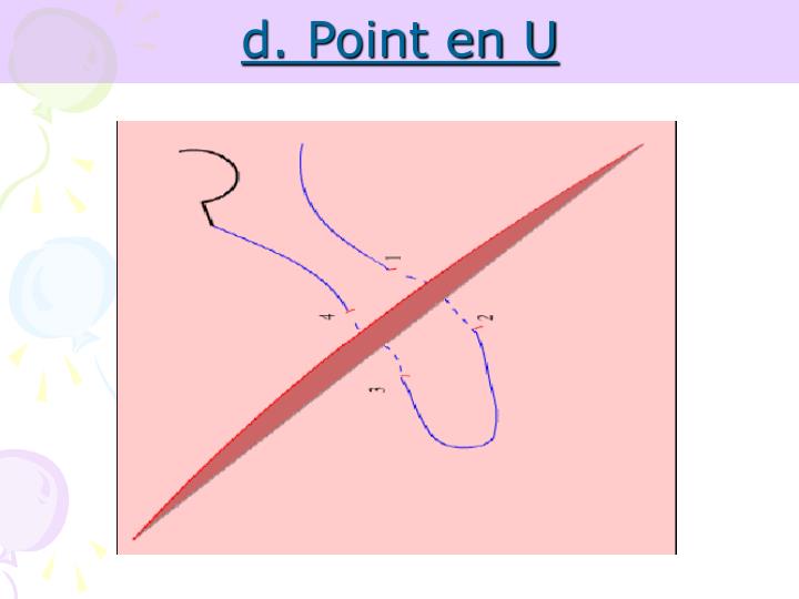 PPT - Ablation de sutures PowerPoint Presentation - ID:1307184