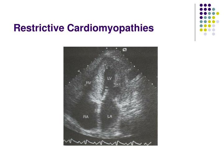 PPT - Echocardiography PowerPoint Presentation - ID:1308117