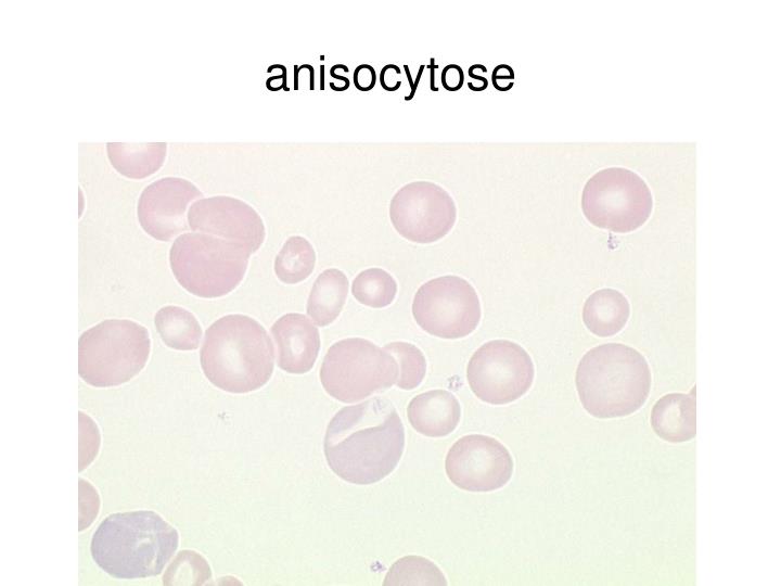 PPT - HEMOGLOBINE PowerPoint Presentation - ID:1308403