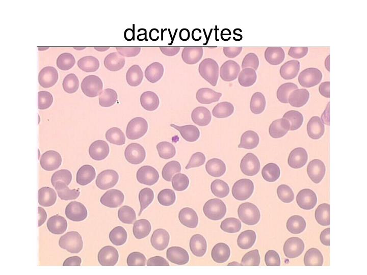 PPT - HEMOGLOBINE PowerPoint Presentation - ID:1308403