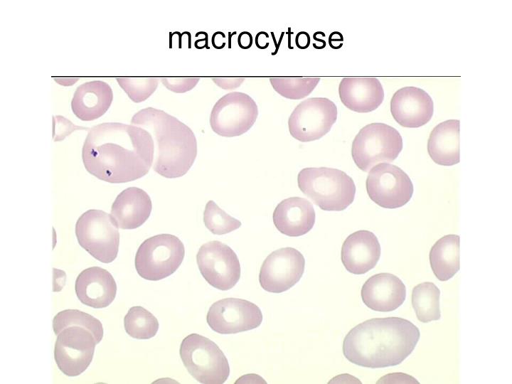 PPT - HEMOGLOBINE PowerPoint Presentation - ID:1308403