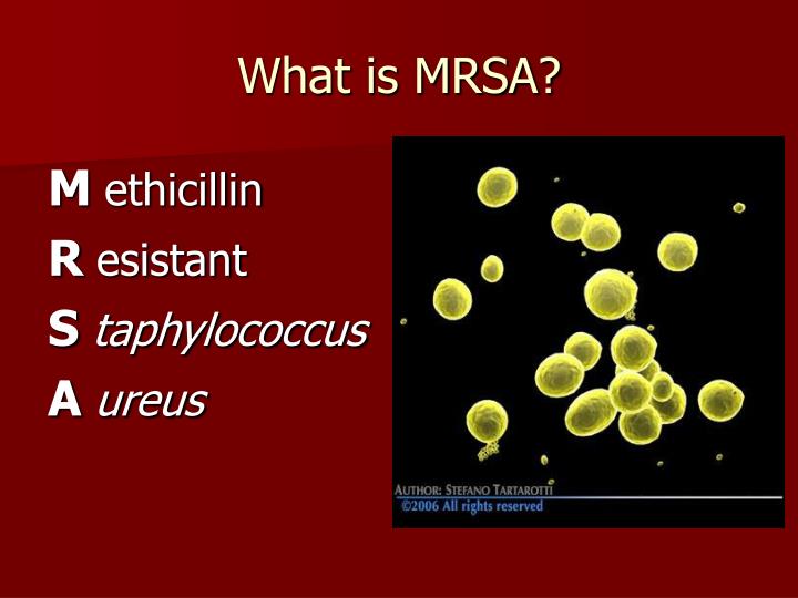PPT - Superbugs and Sepsis PowerPoint Presentation - ID:1308941