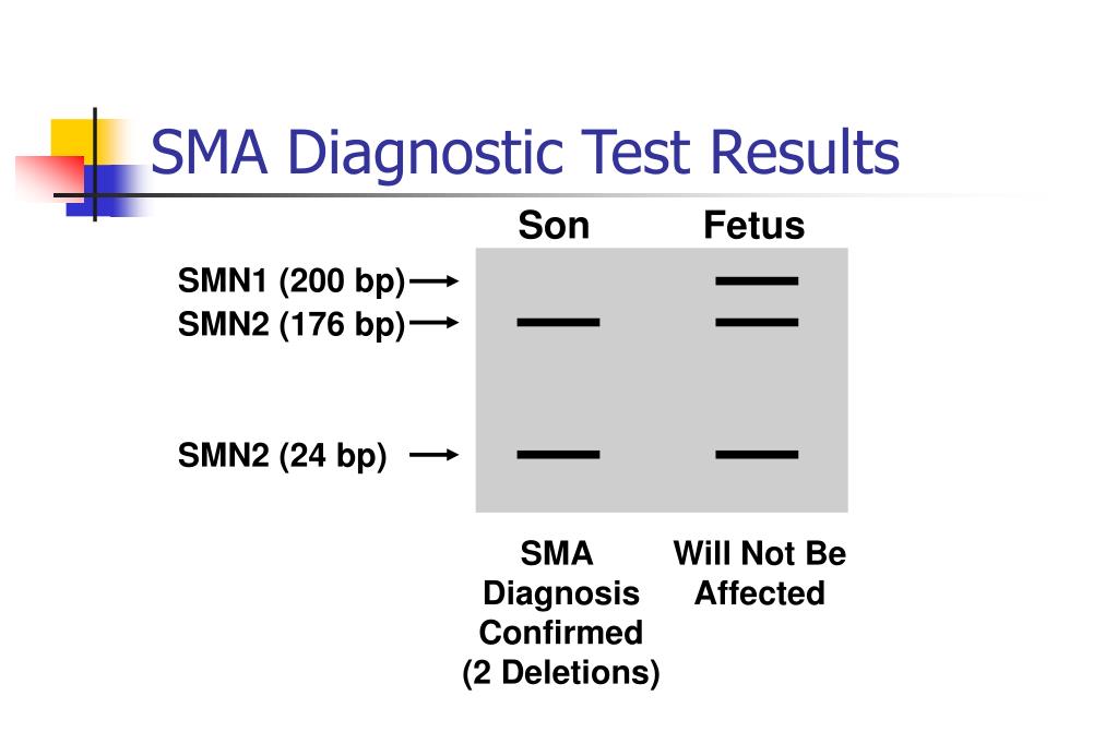 PPT - Genetics: The Whole Picture SMA Takes the Hill 2003 PowerPoint ...