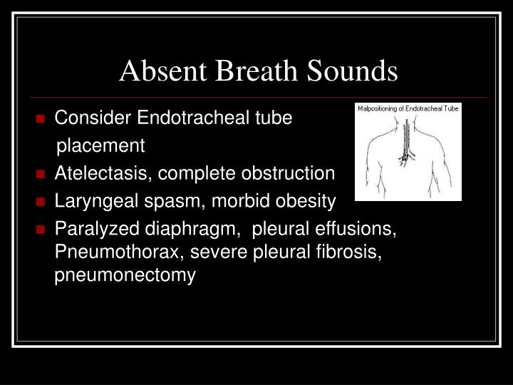 PPT - Breath Sounds PowerPoint Presentation - ID:1310106