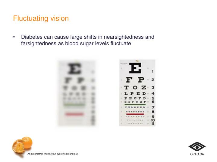 PPT - Diabetes and the Eye PowerPoint Presentation - ID:1310383