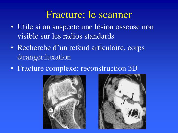 PPT - Traumatologie PowerPoint Presentation - ID:1310669