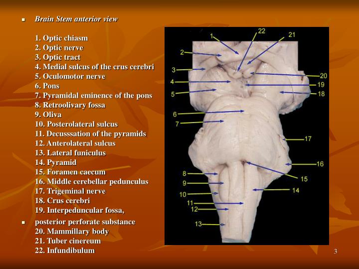 PPT - Localization of Brain Stem Lesions PowerPoint Presentation - ID ...