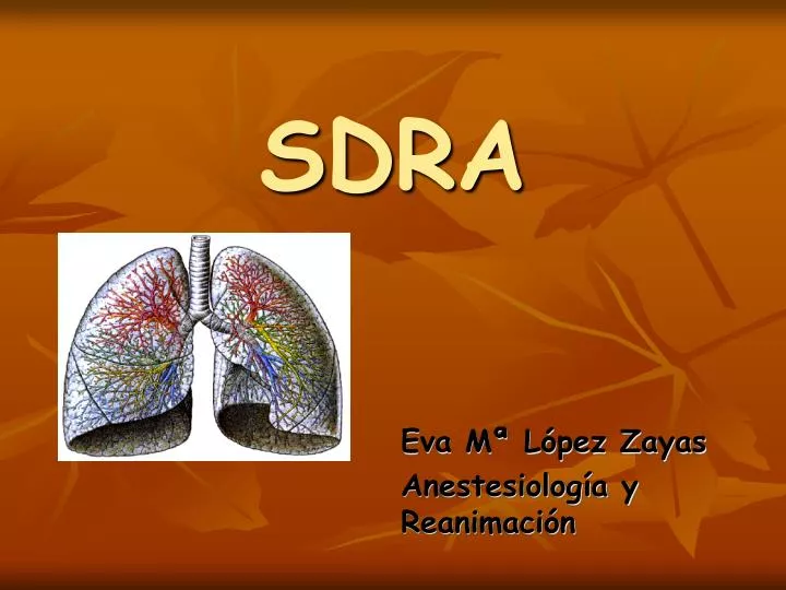 PPT - SDRA PowerPoint Presentation, free download - ID:1314753