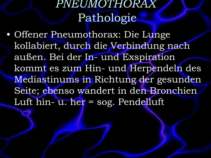 PPT - Thoraxtrauma PowerPoint Presentation - ID:1315193