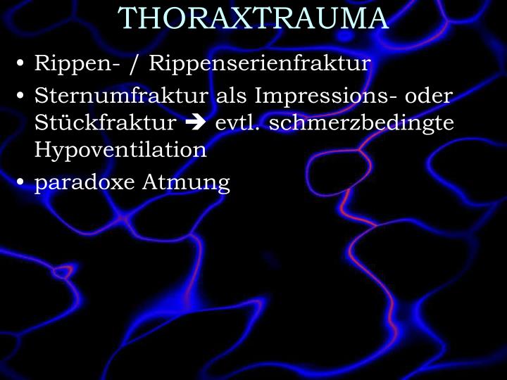 PPT - Thoraxtrauma PowerPoint Presentation - ID:1315193