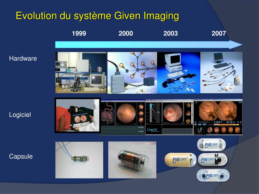 PPT - Capsule colique : une concurrente sérieuse pour l’ hémoccult , la ...