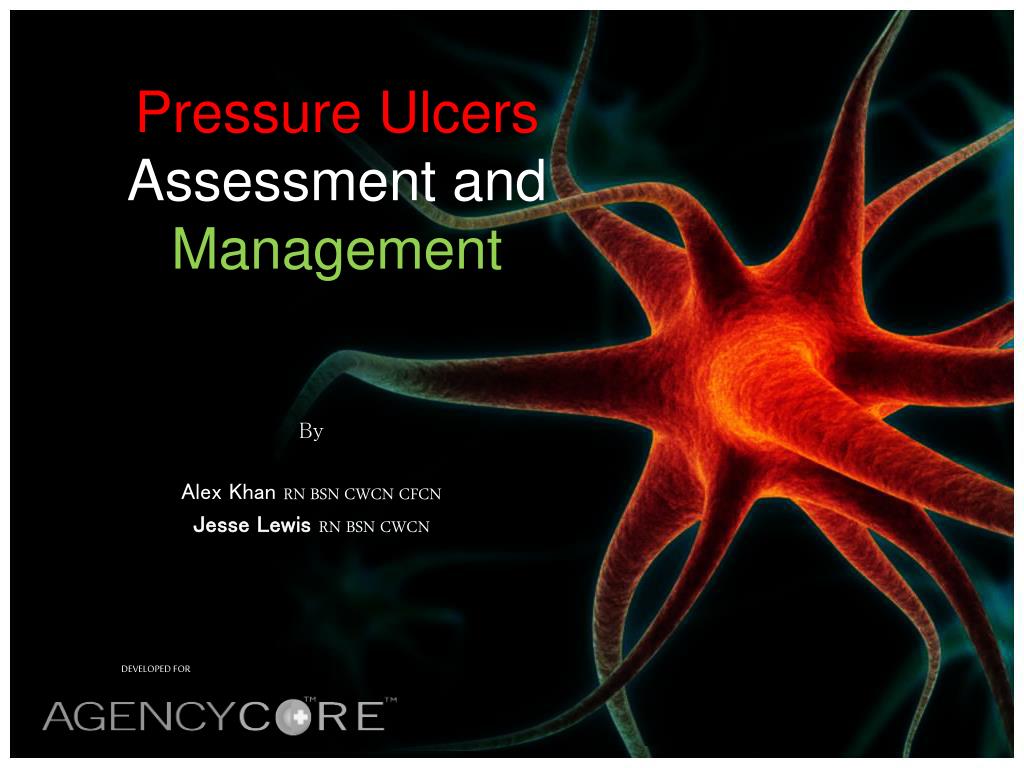 Ppt Pressure Ulcers Assessment And Management Powerpoint Presentation