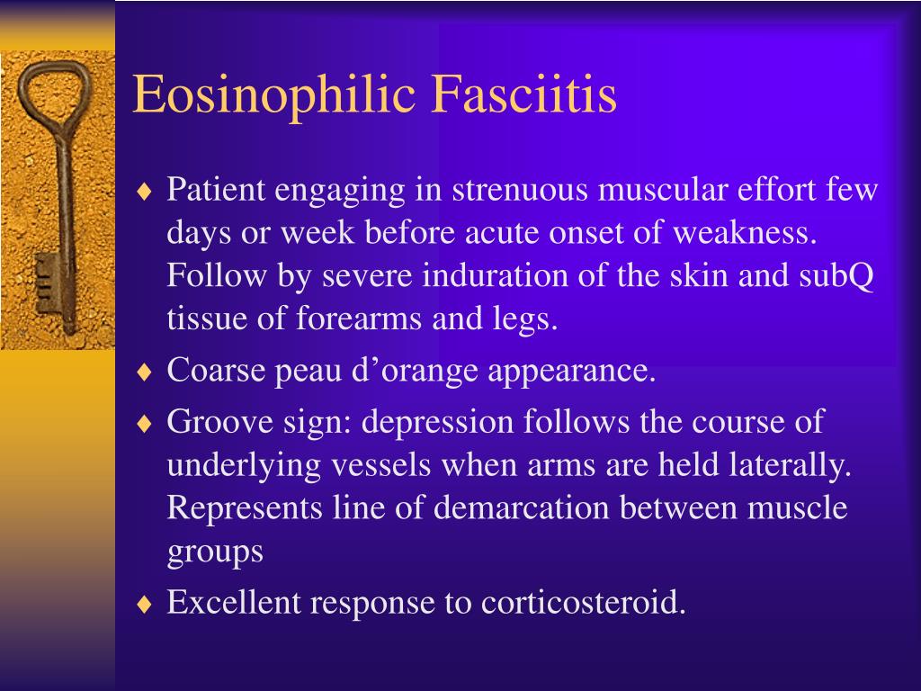 Eosinophilic Fasciitis Groove Sign
