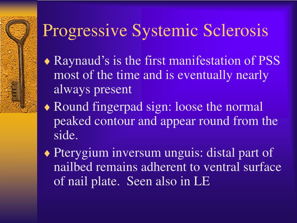 PPT - Connective Tissue Diseases PowerPoint Presentation - ID:1321825