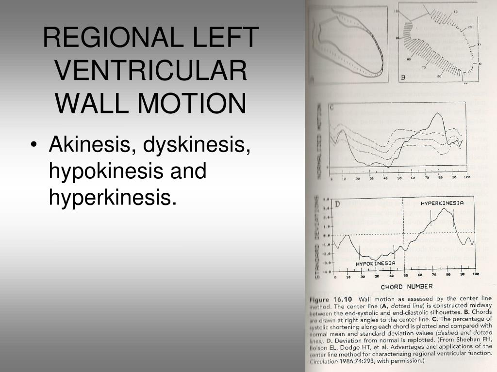 PPT - VENTRICULAR VOLUMES EJECTION FRACTION MASS WALL STRESS REGIONAL WALL MOTION PowerPoint ...