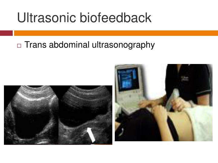 PPT - Biofeedback therapy in pelvic floor disorders PowerPoint ...