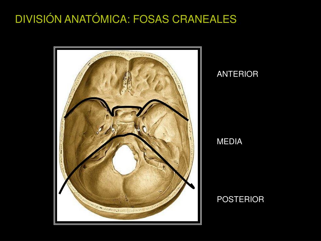 PPT - Conocer la anatomía de la base del cráneo Localización de la ...