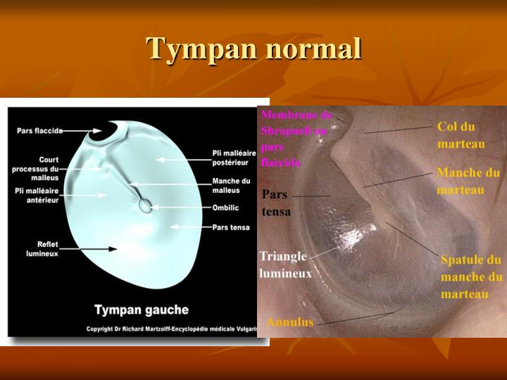 PPT - Infections ORL Antibiothérapie PowerPoint Presentation - ID:1333410