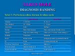 PPT - ULKUS MOLE PowerPoint Presentation - ID:1336992