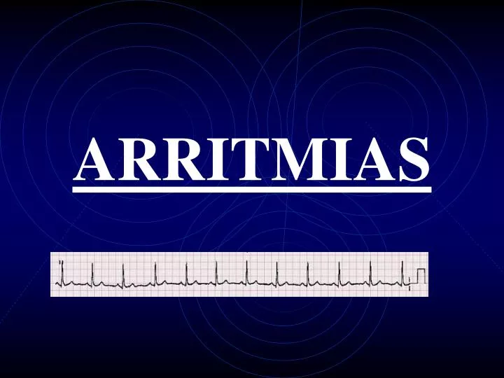 PPT - ARRITMIAS PowerPoint Presentation, free download - ID:1343330