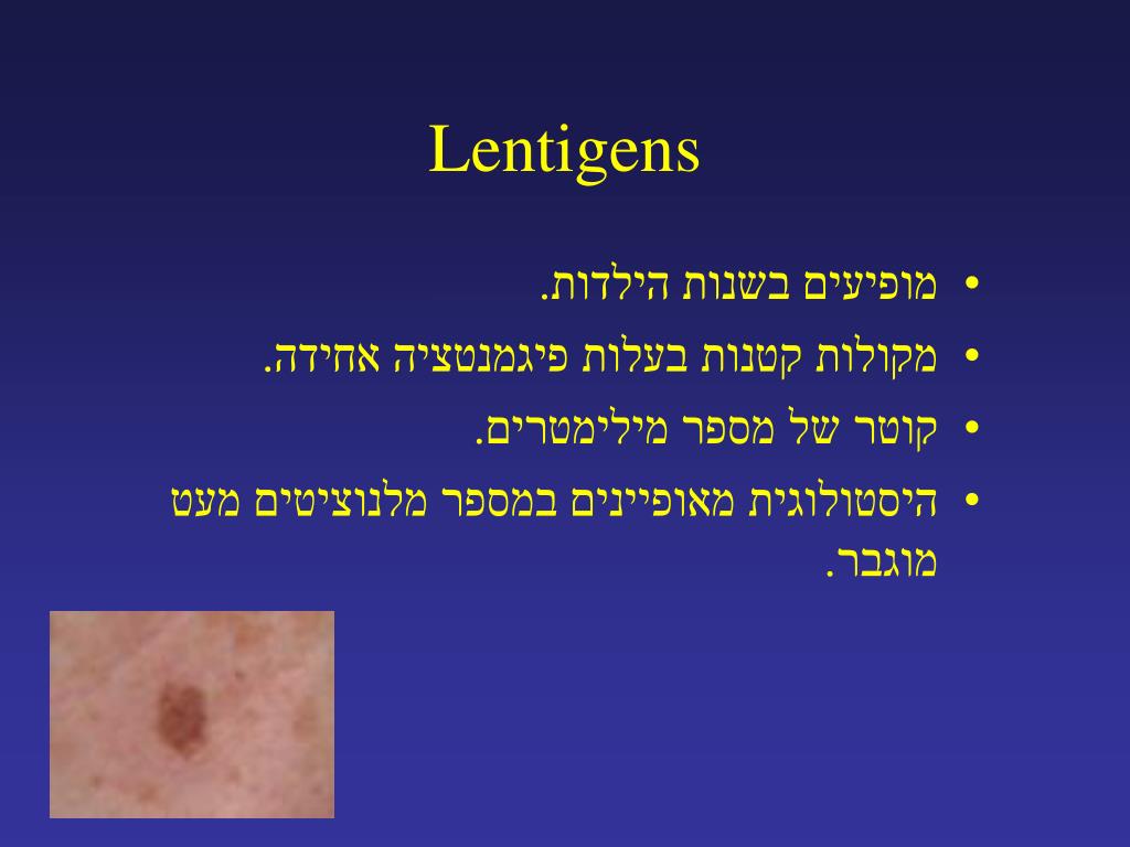 PPT CAF AU LAIT SPOTS DIFFERENTIAL DIAGNOSIS PowerPoint