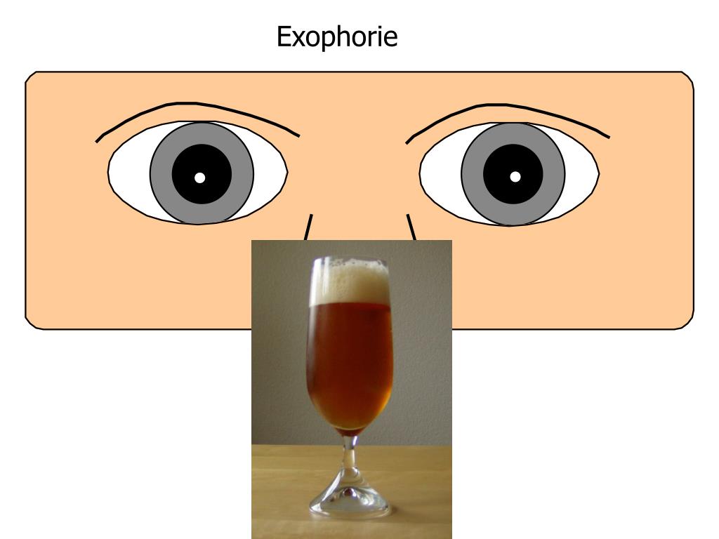 PPT - Augenbewegungen und Schielen PowerPoint Presentation, free ...