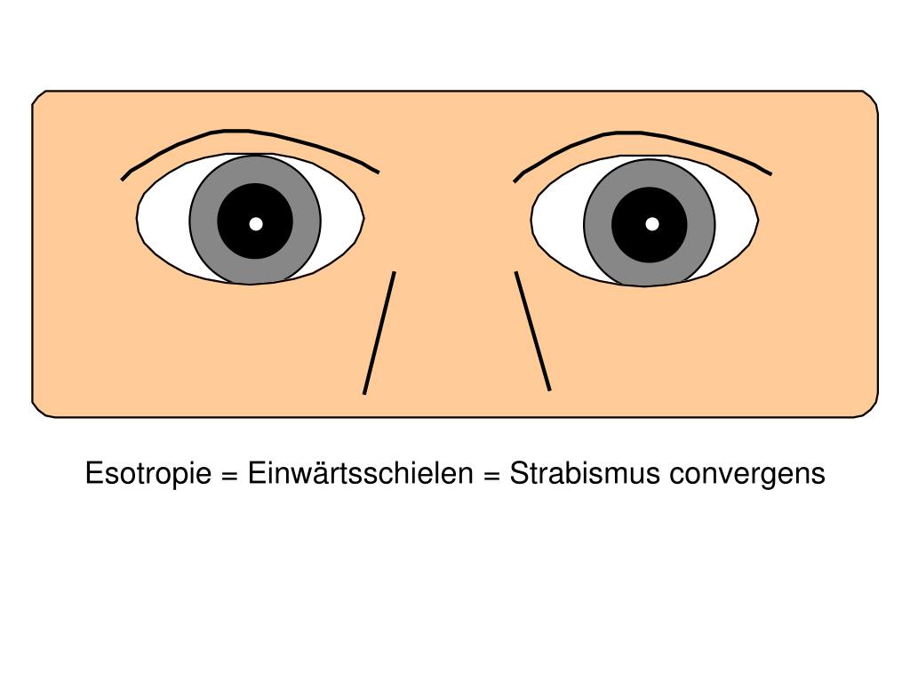 PPT - Augenbewegungen und Schielen PowerPoint Presentation, free ...