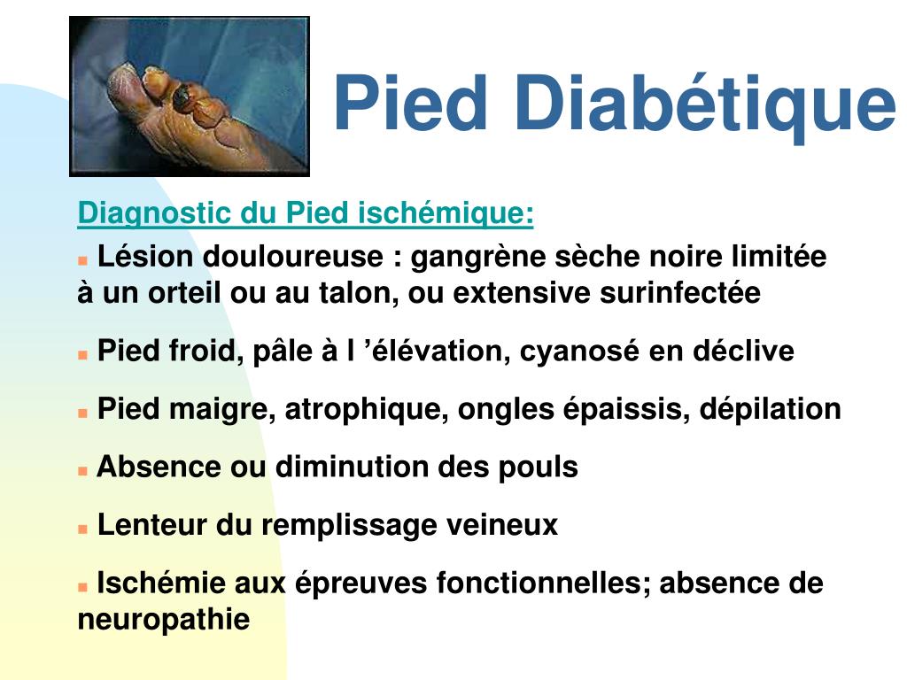 PPT - La microangiopathie diabétique PowerPoint Presentation, free ...