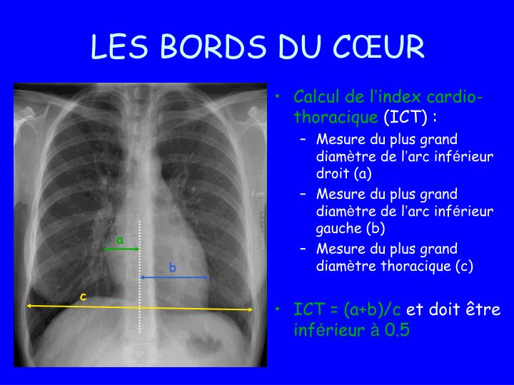 PPT - IMAGERIE CARDIAQUE PowerPoint Presentation - ID:1353109