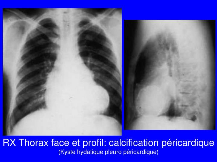 PPT - IMAGERIE CARDIAQUE PowerPoint Presentation - ID:1353109