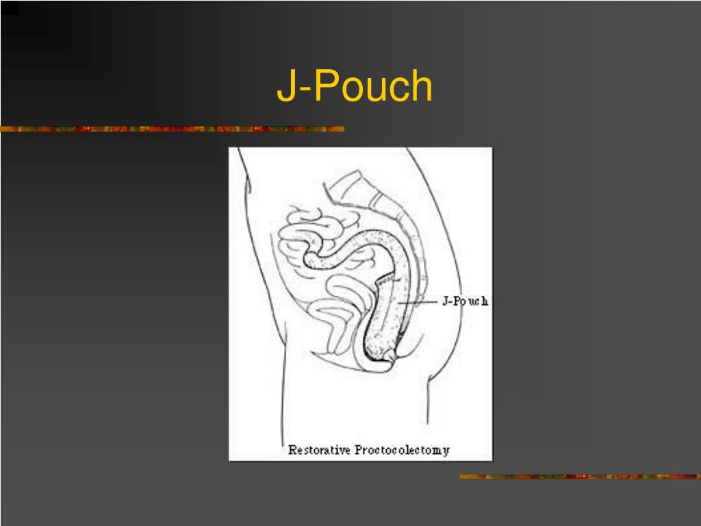 PPT Terminology General PowerPoint Presentation Free Download ID PPT Terminology General PowerPoint Presentation Free Download ID
