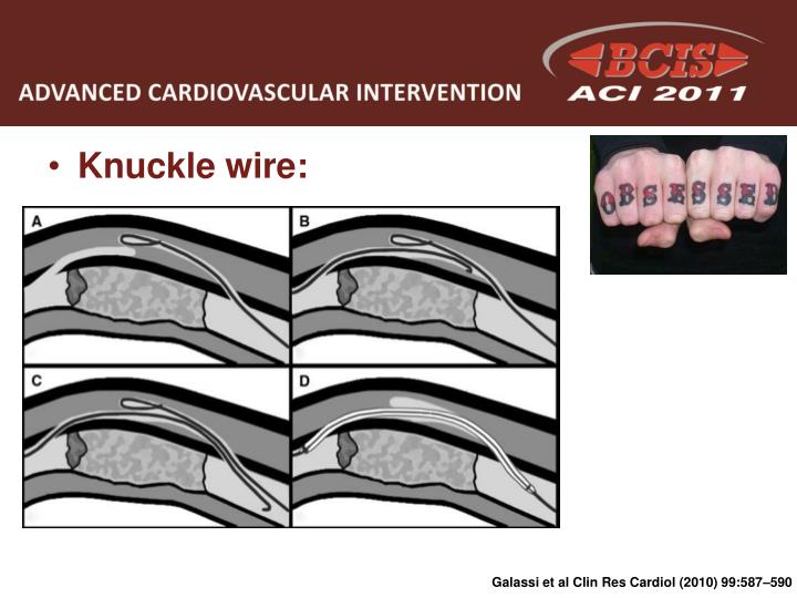 PPT - The language of CTO interventions – what it all means PowerPoint ...