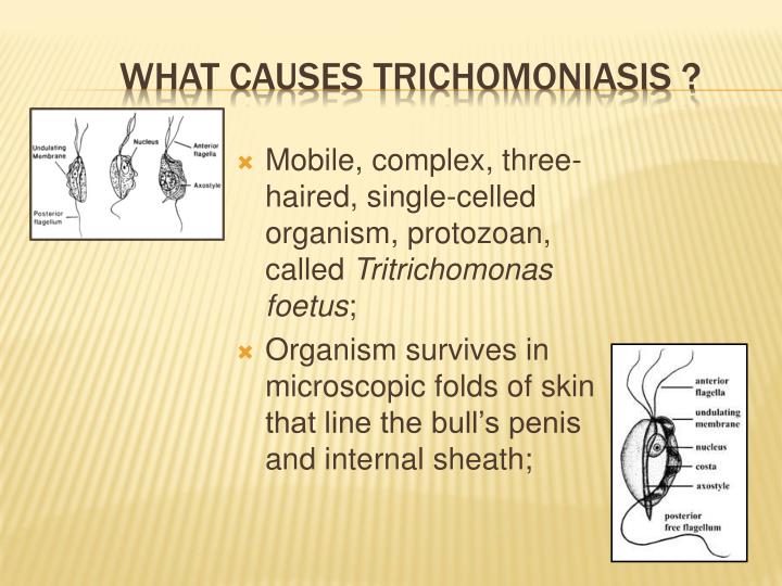 PPT - TRICHOMONIASIS PowerPoint Presentation - ID:1354712