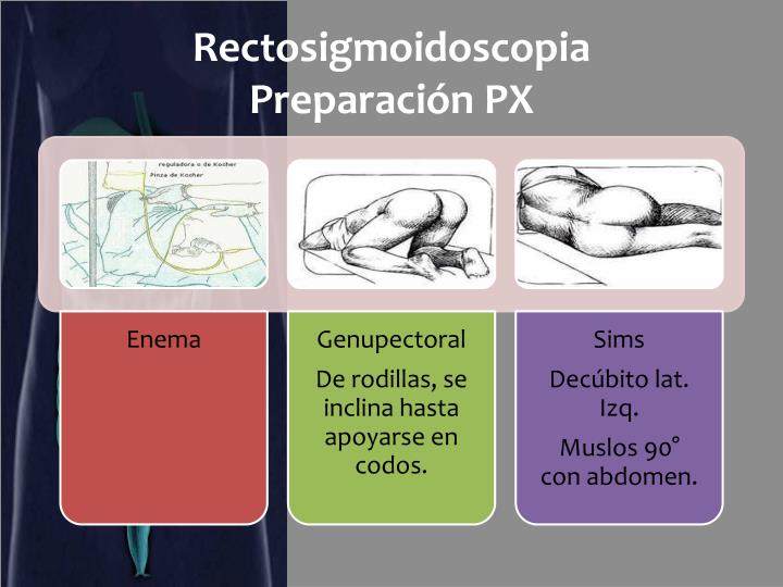 PPT - TACTO RECTAL PowerPoint Presentation - ID:1356253