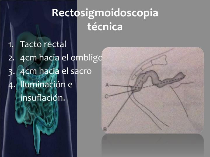 PPT - TACTO RECTAL PowerPoint Presentation - ID:1356253