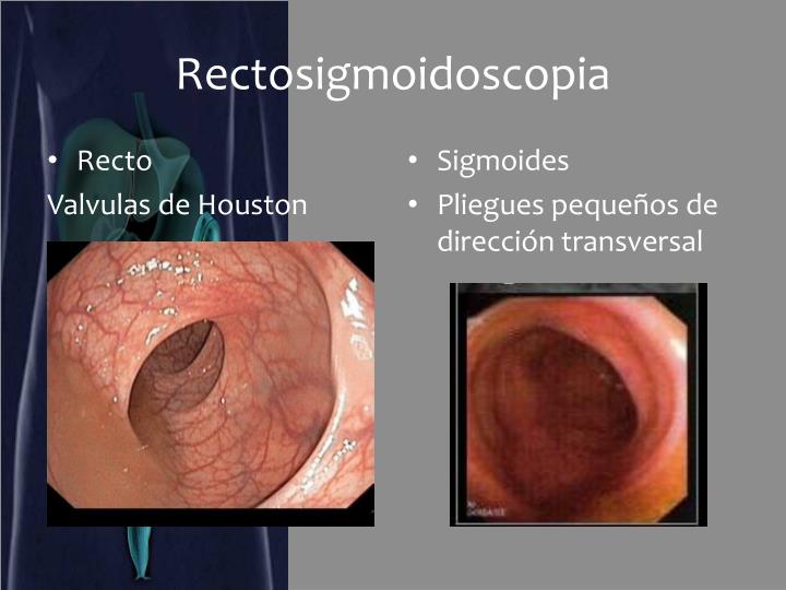 PPT - TACTO RECTAL PowerPoint Presentation - ID:1356253