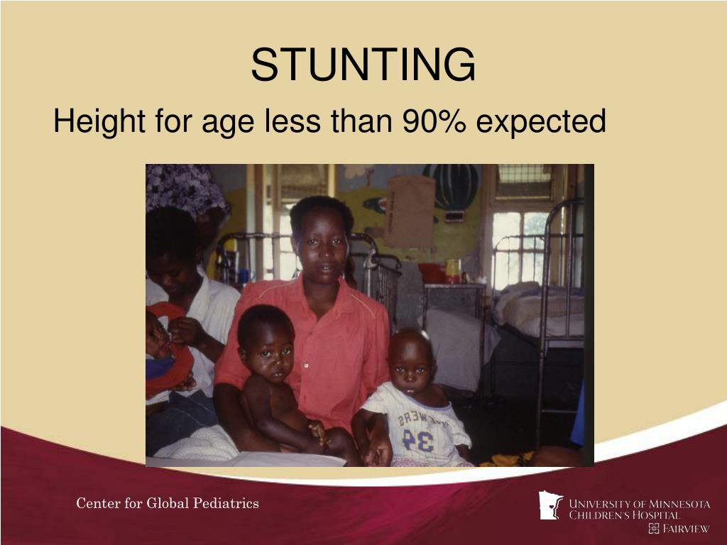 PPT - Protein Energy Malnutrition PowerPoint Presentation, free ...