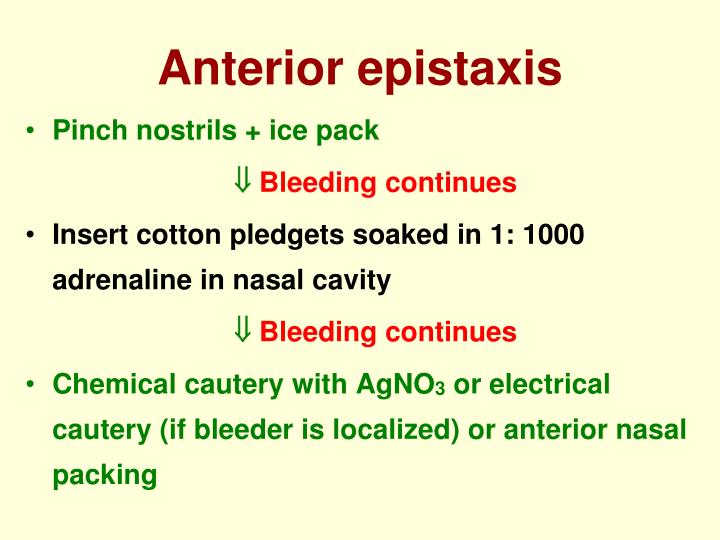 PPT - Epistaxis PowerPoint Presentation - ID:1364903