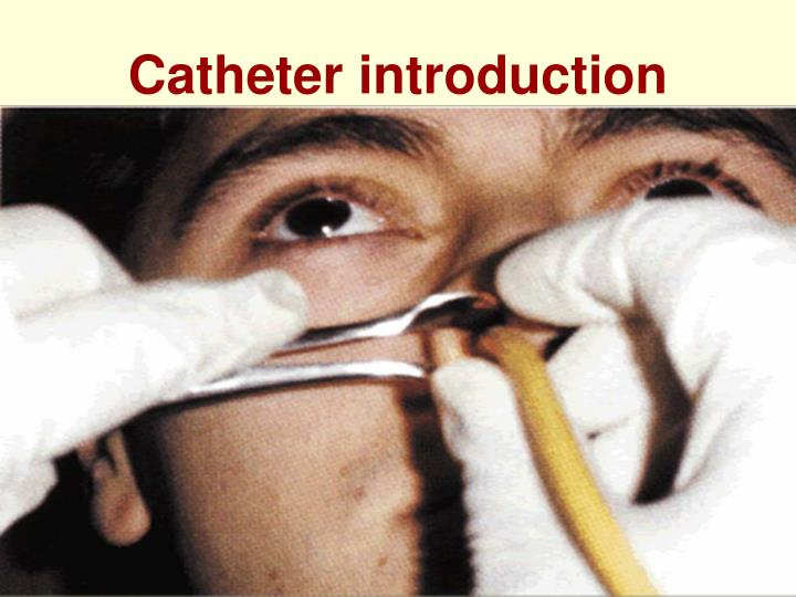 PPT - Epistaxis PowerPoint Presentation - ID:1364903