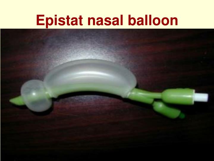 PPT - Epistaxis PowerPoint Presentation - ID:1364903