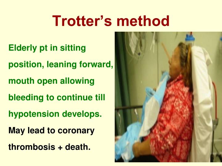 PPT - Epistaxis PowerPoint Presentation - ID:1364903